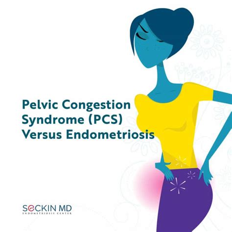 Pelvic Congestion Syndrome Pcs Versus Endometriosis