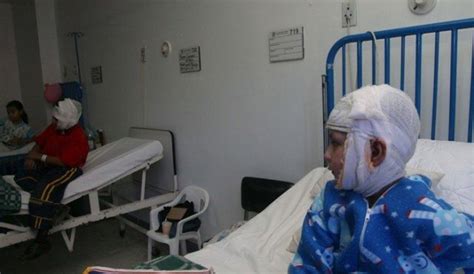 8 Quemados Con Pólvora En Tolima Entre Ellos 2 Niños El Fin De Semana