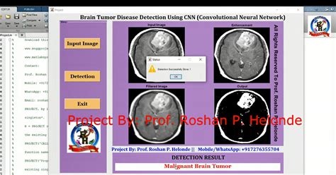 Brain Tumor Detection Using Convolutional Neural Network Cnn Matlab Project With Source Code