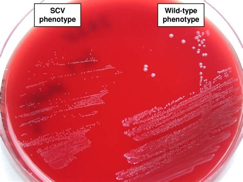 Enterococcus Faecalis Gram Stain Morphology