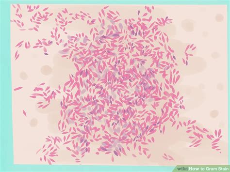 How To Gram Stain With Pictures WikiHow