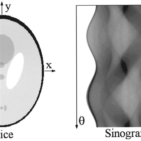 A Sinogram Sinograms Provide A Visual Representation Of Raw Xct Data Download Scientific