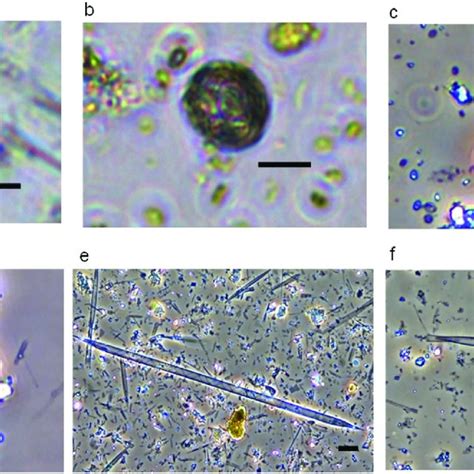 Example Micrographs Of Most Abundant Phytoplankton Functional Types