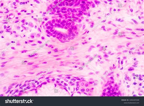 Bone Connective Tissue Royalty Free Images Stock Photos Pictures Shutterstock