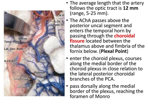 Anterior Choroidal Arterypptx