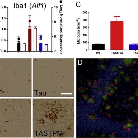 A Aβ Staining With Biotinylated Hj34 Antibody Against Aβ113 In The