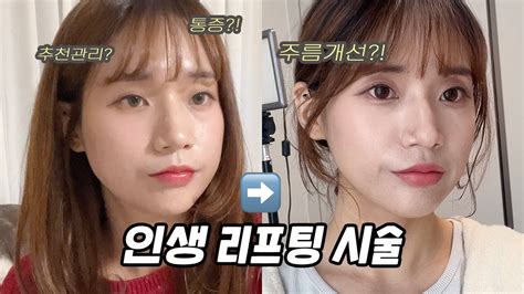 인생 리프팅 시술 발견💡 텐써마리프팅 효과 이렇게나 좋다고⁉️ 고통 전후비교 인모드 시술 비교 추천ㅣ피부과 시술 브이로그 Vlog Youtube