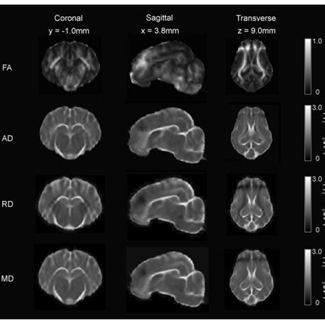 Diffusion Weighted Scalar Template Maps The Fractional Anisotropy Download Scientific