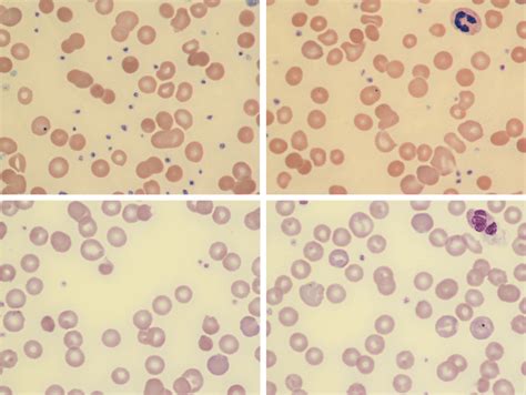 Howell Jolly Bodies