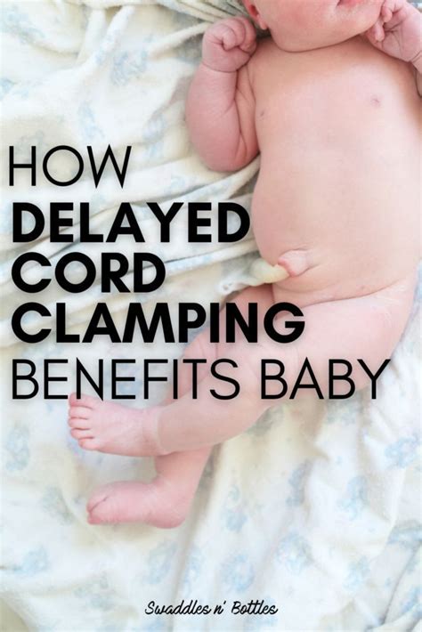Delayed Cord Clamping And Risks Artofit