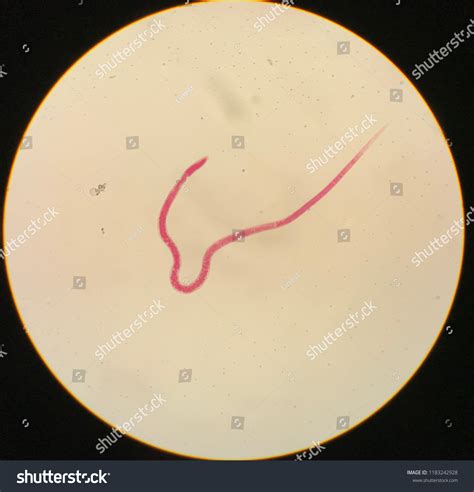 Light Micrograph Of Trichinella Spiralis Teased Trichinella Spiralis