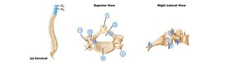 Vertebrae Flashcards Quizlet