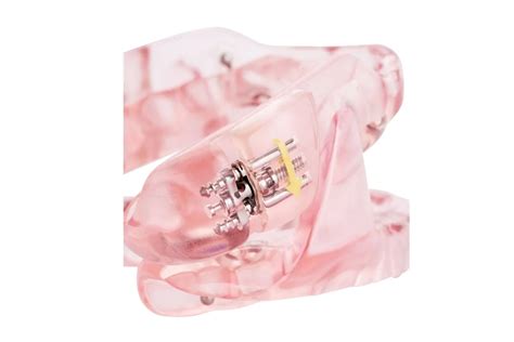 Somnodent® Classic Somnomed Canada