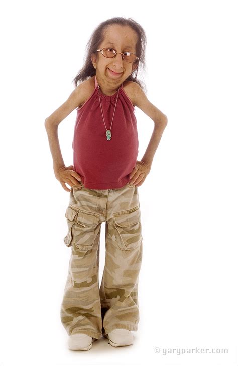 Primordial Dwarfism