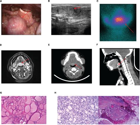 The Clinicopathological Features Treatment Outcomes And Follow Up