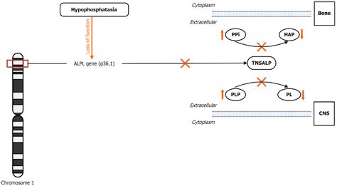 Hypophosphatasia A Case Report