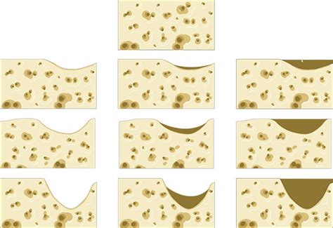 Bone Structure Vector