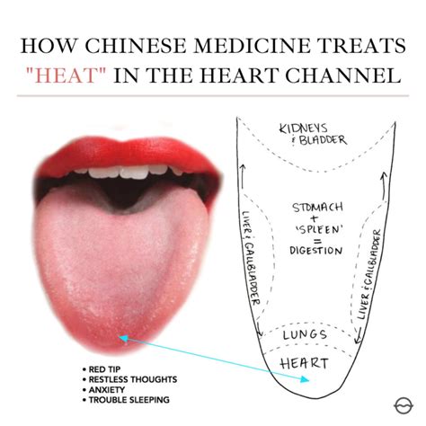 Listen To Your Tongue What Does A Red Tip Mean In Chinese Medicine