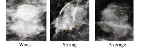 Detection From Various Densities Download Scientific Diagram