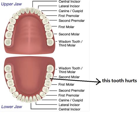 Word Choice Is It Correct To Say Could You Check My Second Tooth