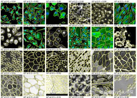 细胞分割神器——cellpose（安装篇） 知乎