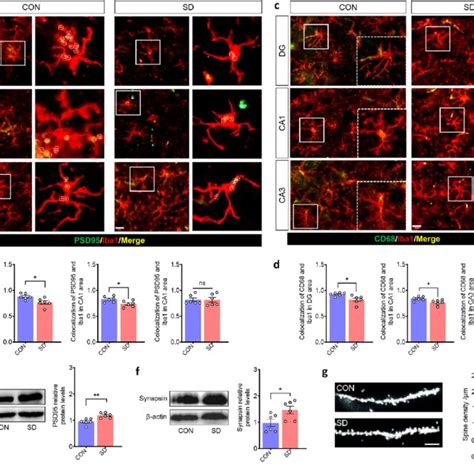 Effects Of Sleep Deprivation Sd On Microglia Mediated Synaptic