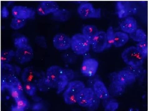 Abnova Her2cen17 Fish Probe Her2cen17 Fish Probebiochemical Reagents