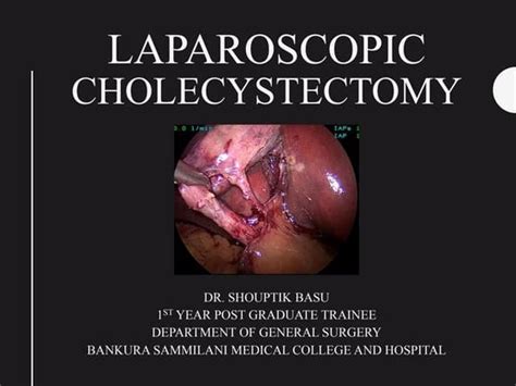 Laparoscopic Cholecystectomy Operative Surgery Ppt