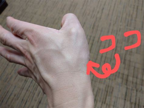 親指の付け根が痛い！母指cm関節症！ 「腰痛施術の匠」橋爪接骨院の猪突猛進ヅメ日記