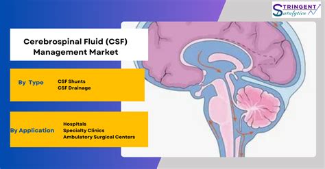 Cerebrospinal Fluid Csf Management Market Analysis Trends And
