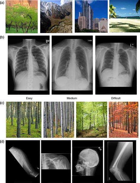 Examples Of Images Used To Test Visual Recognition Memory Of Download Scientific Diagram