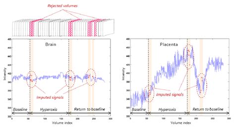 An Example Of Volume Outlier Rejection And Missing Data Recovery At