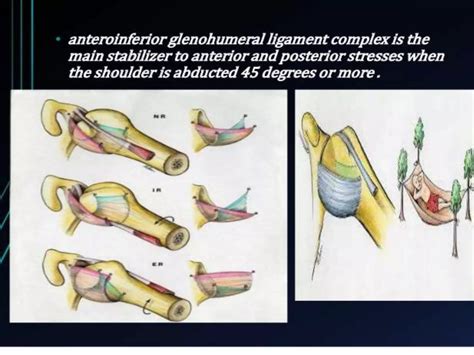 Shoulder Dislocationcation Ppt