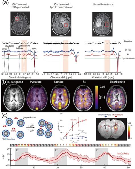 Metabolites Detection Using Mrsmri A Localized 1 H Mrs Of An