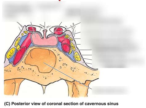 Cavernous Sinus Anatomy Coronal