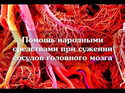 Помощь народными средствами при сужении сосудов головного мозга - YouTube