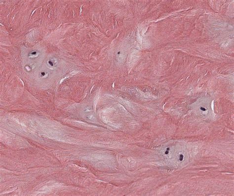 Cartilagebonemuscle Histology Notes Medical Histology Jacobs