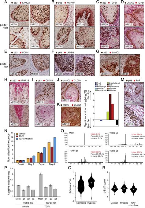 Single Cell Transcriptomic Analysis Of Primary And Metastatic Tumor