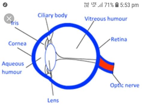 Schematic Diagram Of Eye Defects
