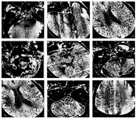 Mnff Gnn Multi Order Neighbor Feature Fusion Graph Neural Network