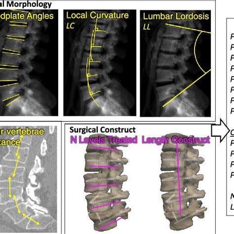 Calculation Of Automatic Image Analytics From Spine Ct At Preoperative Download Scientific