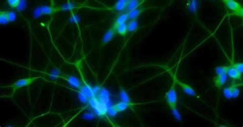 Second Type Of Stem Cell Was Found In The Mouse Brain Assignment Point