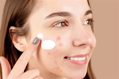 12 Rekomendasi Skincare Untuk Kulit Berminyak Dan Berjerawat