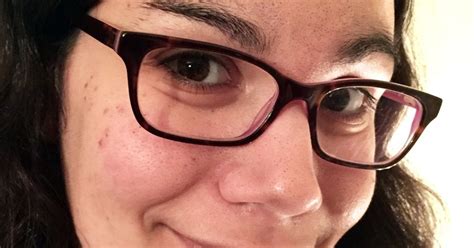 Why I Cant Stop Picking My Skin