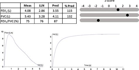 Reference Values For Spirometry And Their Use In Test Interpretation A
