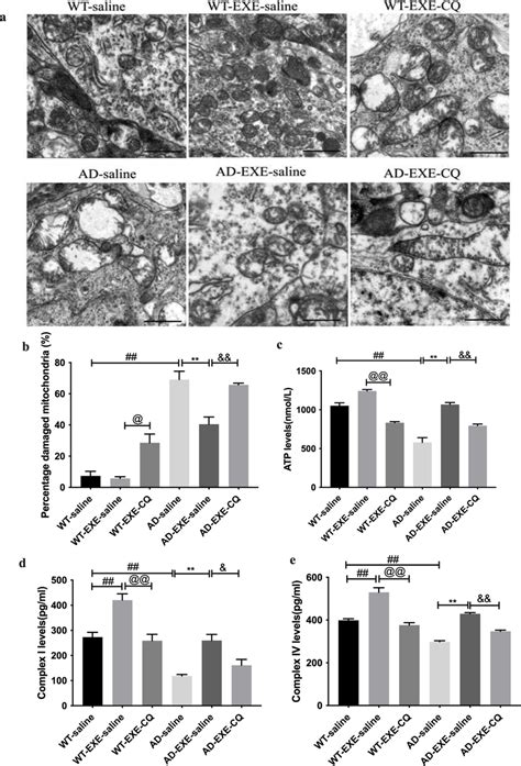 The Effect Of Treadmill Exercise On Mitochondrial Dysfunctions The Download Scientific Diagram