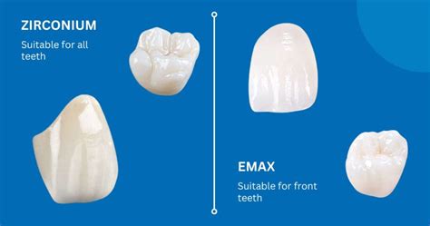 Zirconia Crown Vs Emax Choosing The Perfect Crown For Your Smile