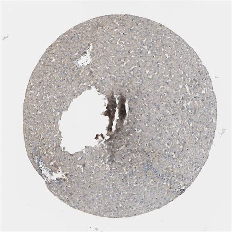Tissue Expression Of Cd276 Staining In Liver The Human Protein Atlas