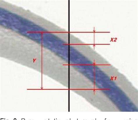Figure 2 From Reciprocating 파일 시스템에서 Glide Path가 근관만곡도 유지에 미치는 영향