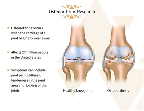 Assistive Door Handle Converter On Behance